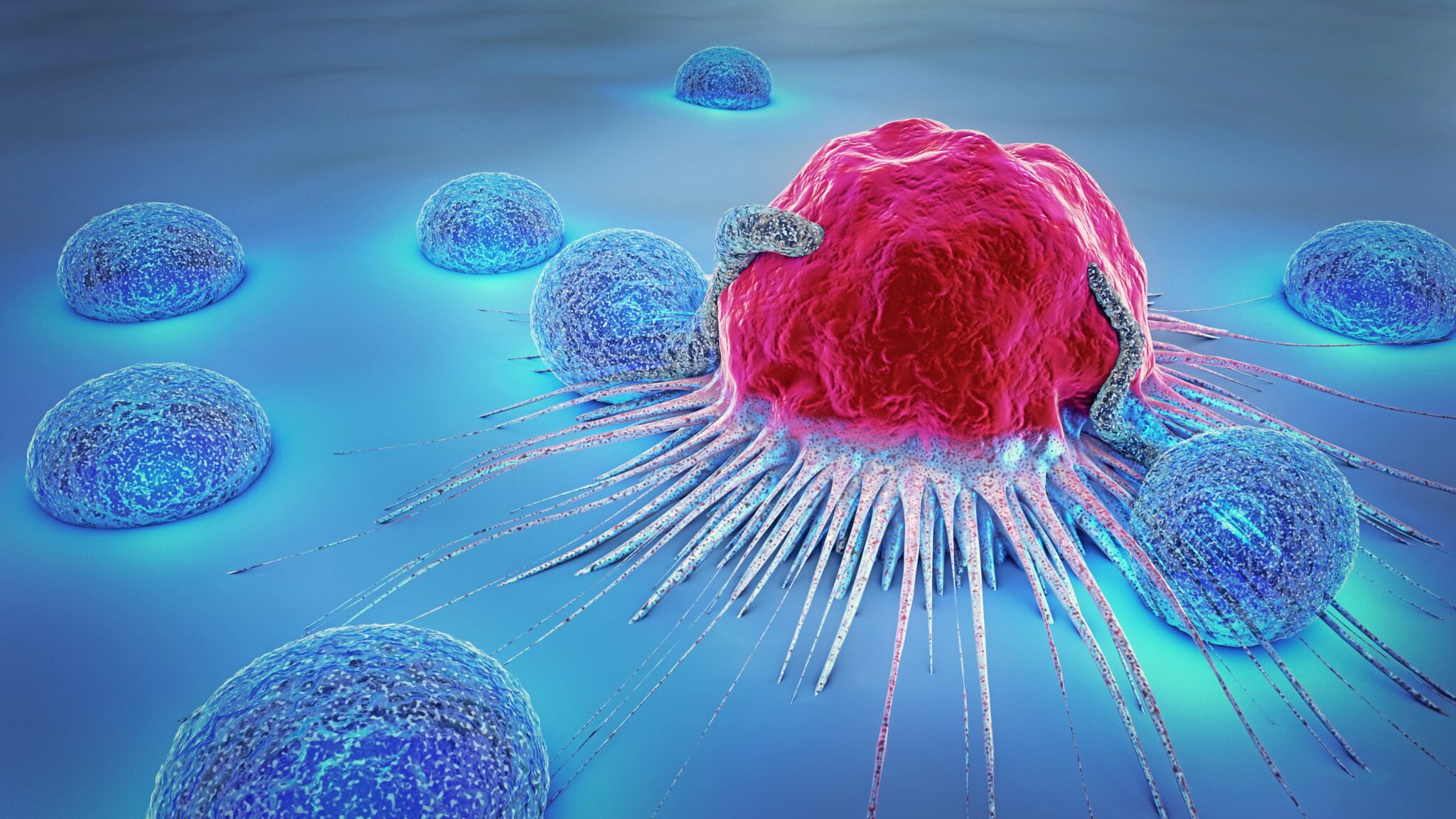 Does Cancer Exacerbate Risk Of Cardiovascular Disease Prevencio Med does-cancer-exacerbate-risk-of-cardiovascular-disease-prevencio-med